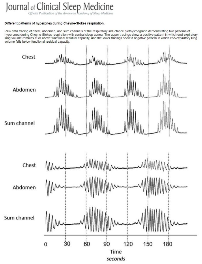 Two Distinct Patterns of Hyperpnea During Cheyne-Stokes Respiration ...