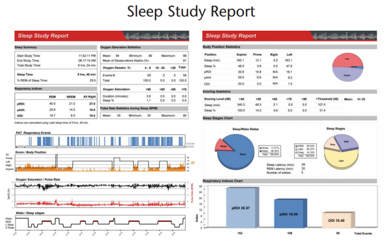 How reliable is your sleep study data? - Thoracic and Sleep Group Queensland